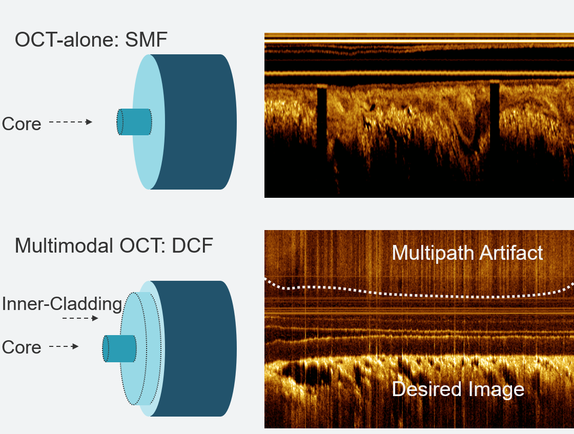 Optical Cancer Imaging Lab - Screening and Diagnosis with LightOptical ...