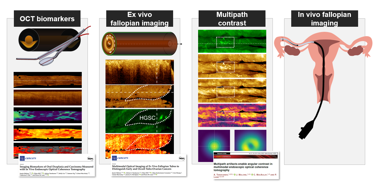 Congratulations Dr. Malone! - Optical Cancer Imaging Lab